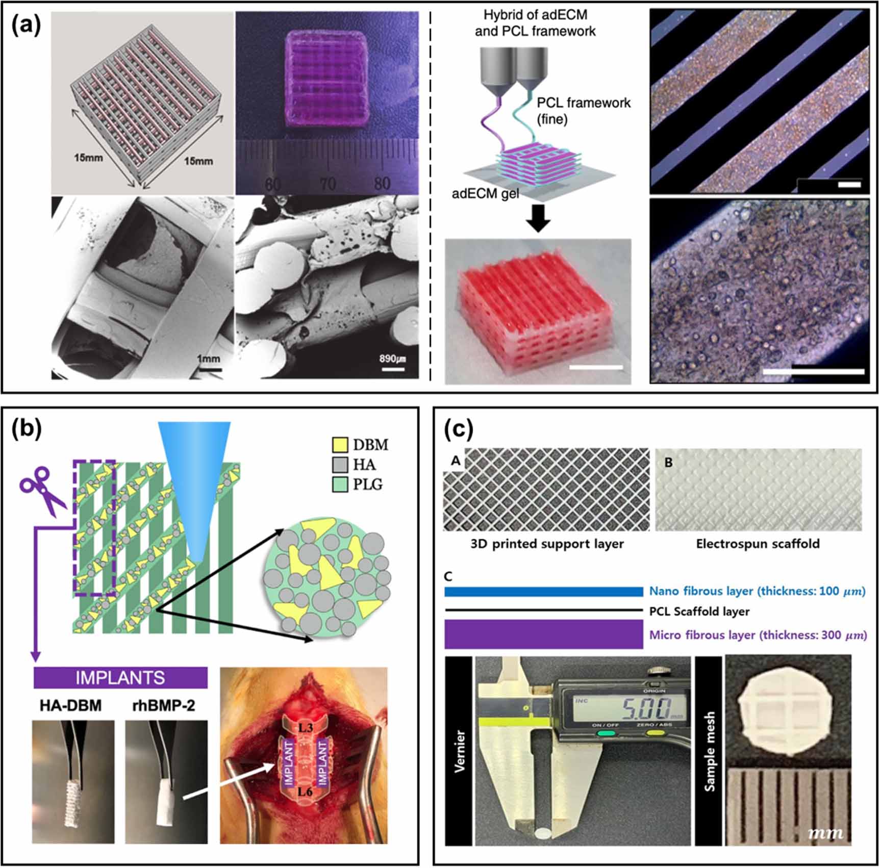 Biomaterials of human source for 3D printing strategies - IOPscience