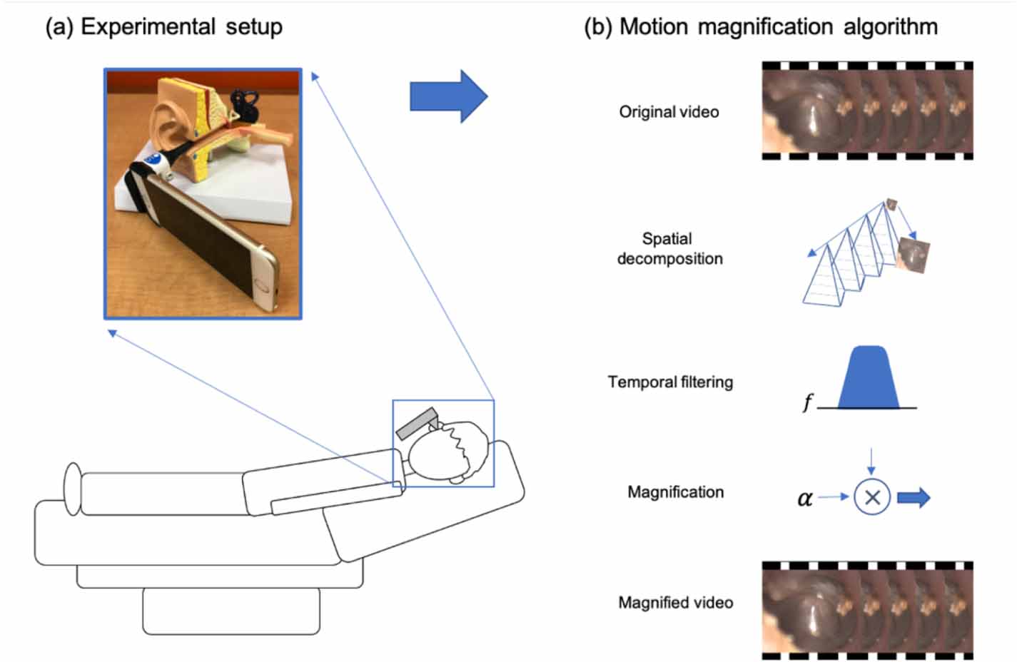 Phase-based Eulerian motion magnification reveals eardrum mobility from pneumatic otoscopy ...