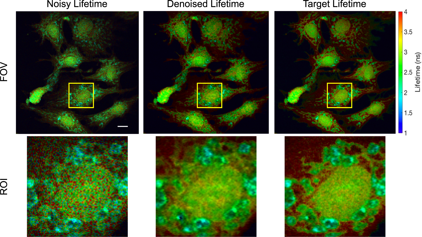 Machine learning for faster and smarter fluorescence lifetime imaging ...