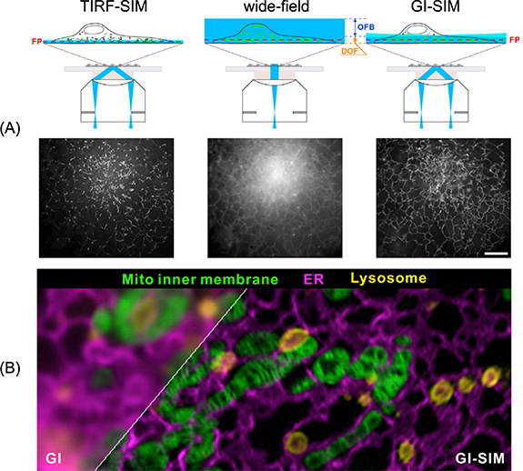 Recent advances in structured illumination microscopy - IOPscience