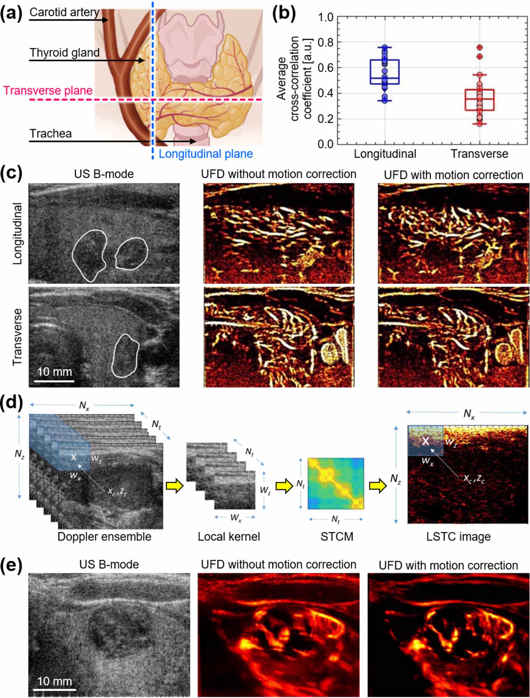 In vivo photoacoustic and ultrafast ultrasound Doppler assessment of ...