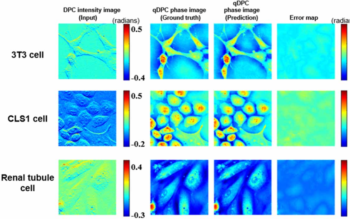 Quantitative differential phase contrast imaging system using FPGA for ...