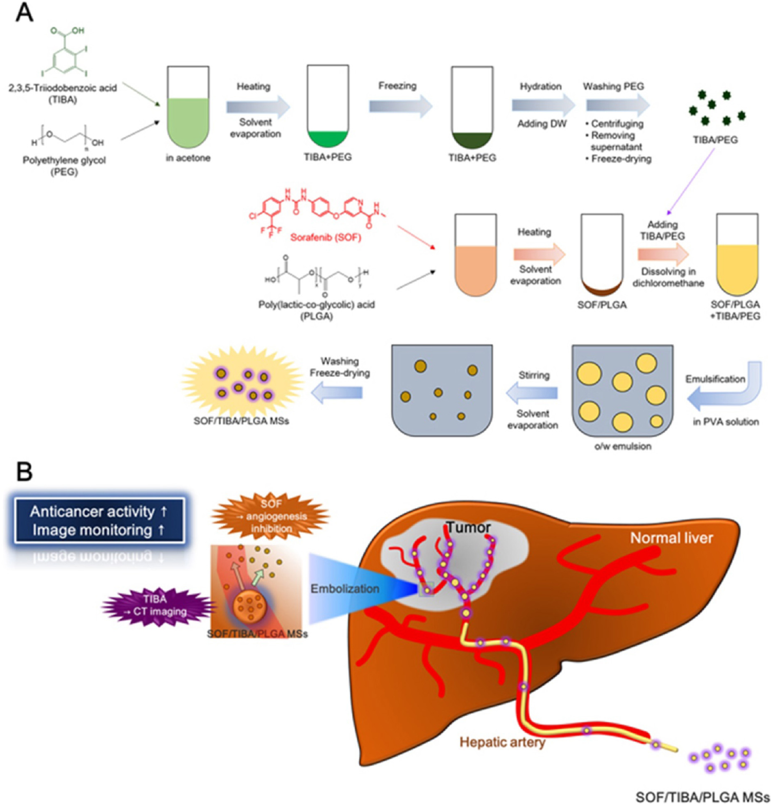 Emerging embolic agents in endovascular embolization: an overview ...