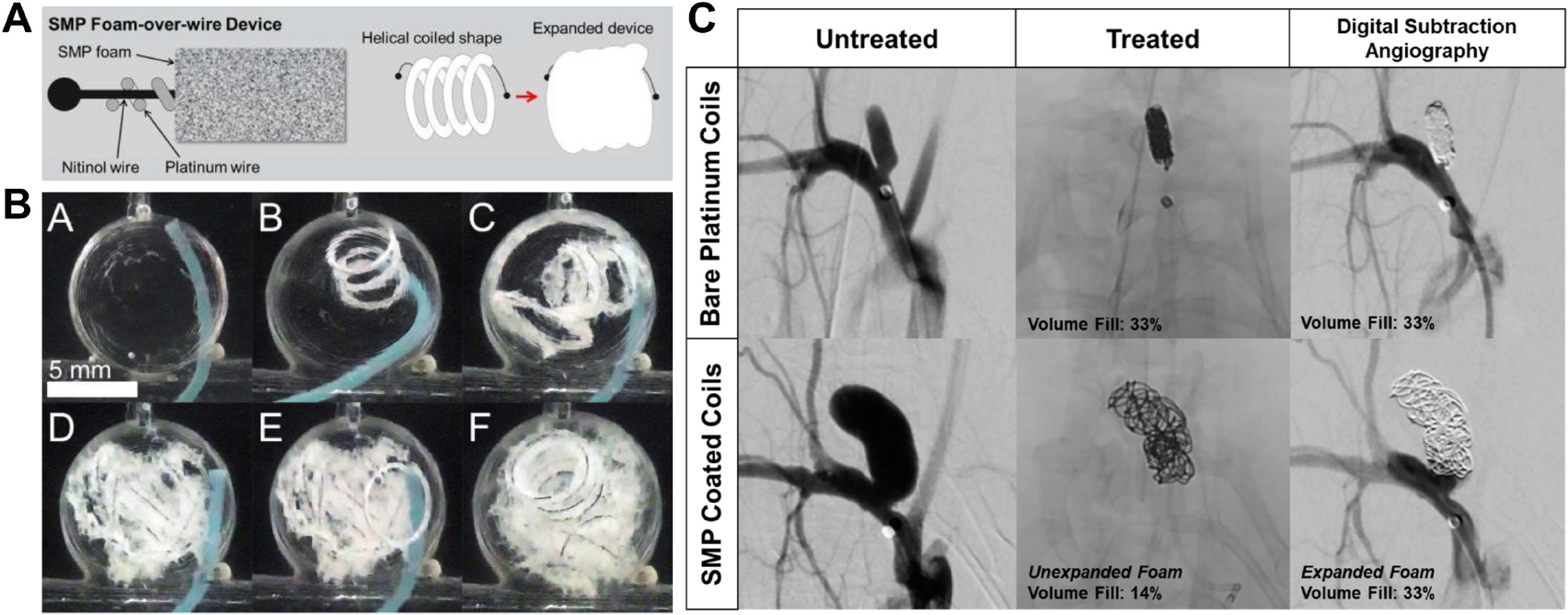 Emerging embolic agents in endovascular embolization: an overview ...