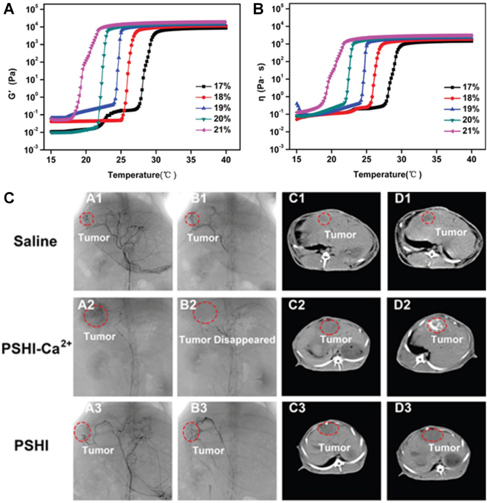 Emerging embolic agents in endovascular embolization: an overview ...