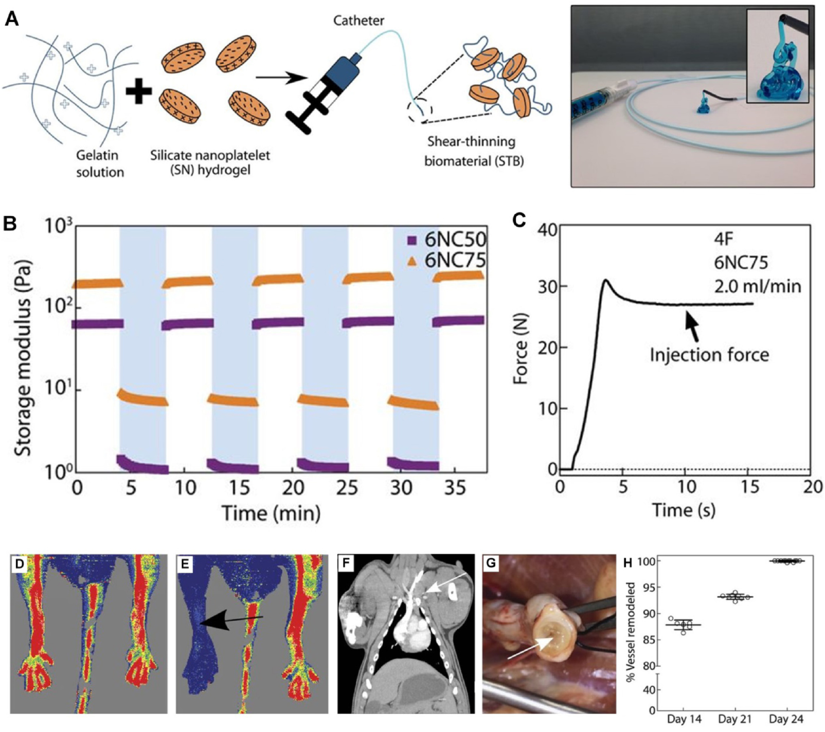 Emerging embolic agents in endovascular embolization: an overview ...