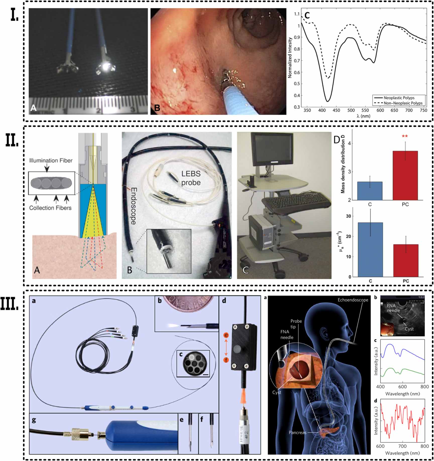 Optical spectroscopy for in vivo medical diagnosis—a review of the ...