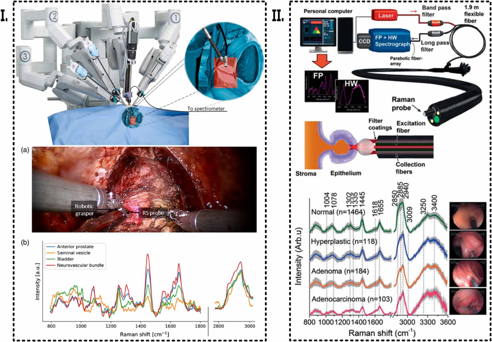 Optical spectroscopy for in vivo medical diagnosis—a review of the ...