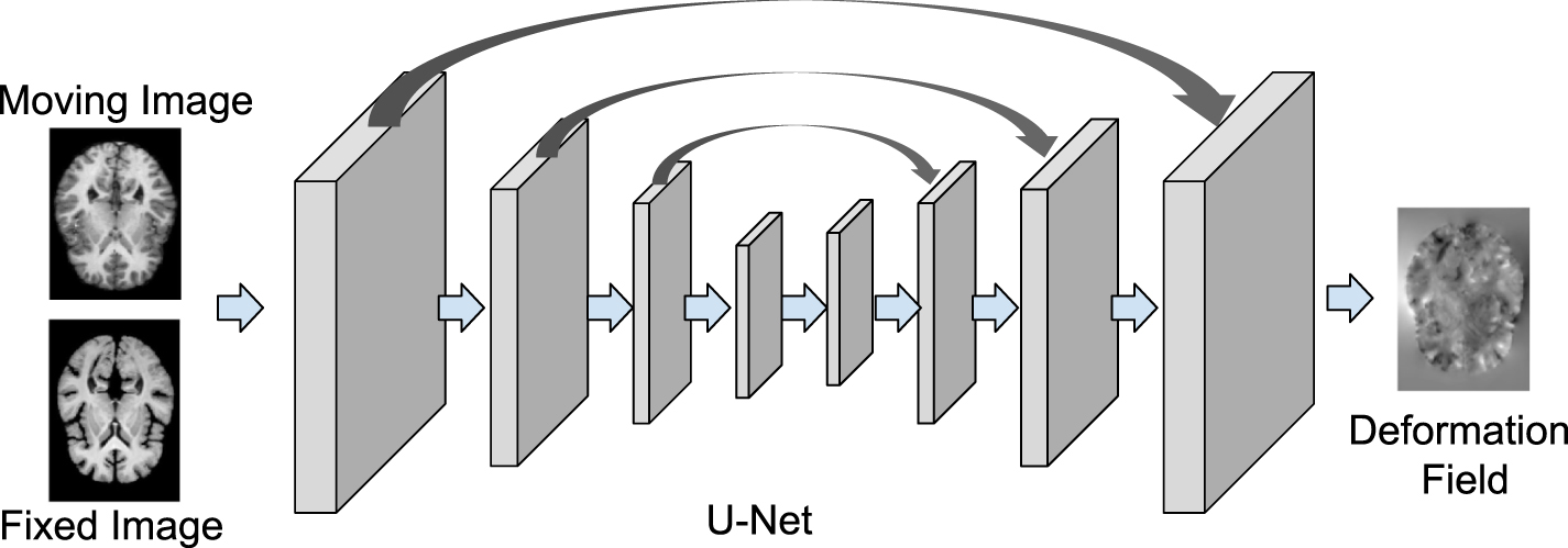 Deep learning in medical image registration - IOPscience