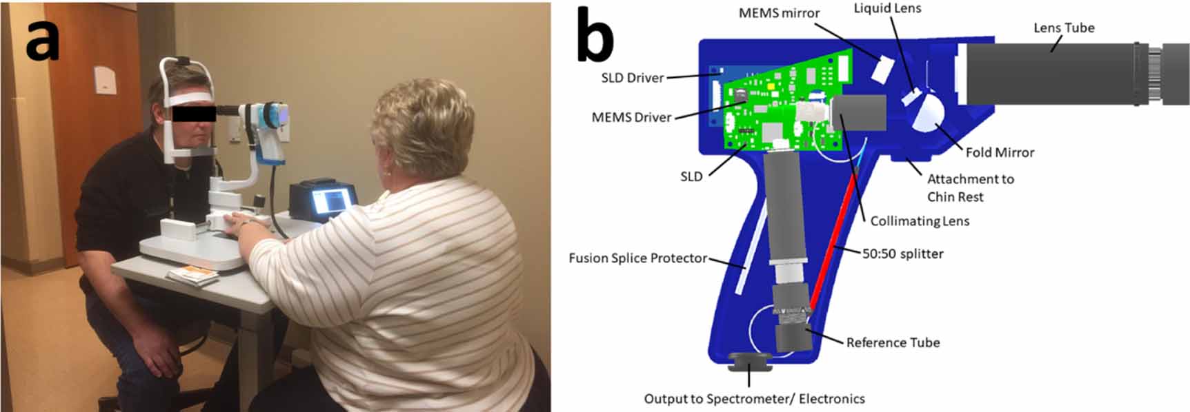 A review of low-cost and portable optical coherence tomography - IOPscience