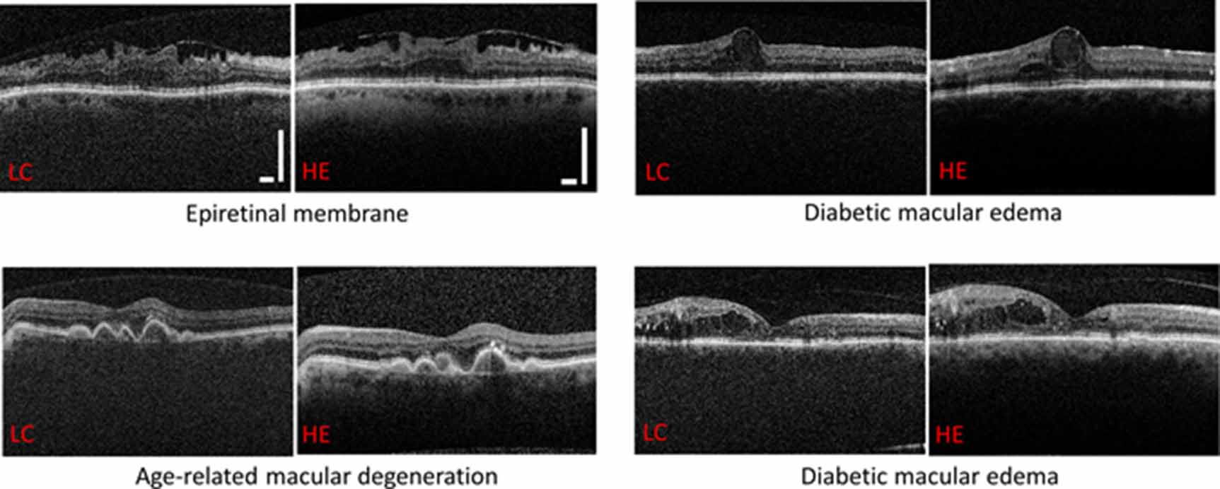 A review of low-cost and portable optical coherence tomography - IOPscience