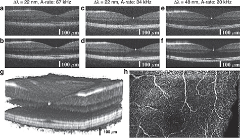 A review of low-cost and portable optical coherence tomography - IOPscience