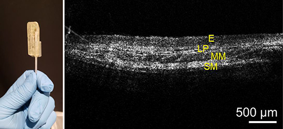 A review of low-cost and portable optical coherence tomography - IOPscience