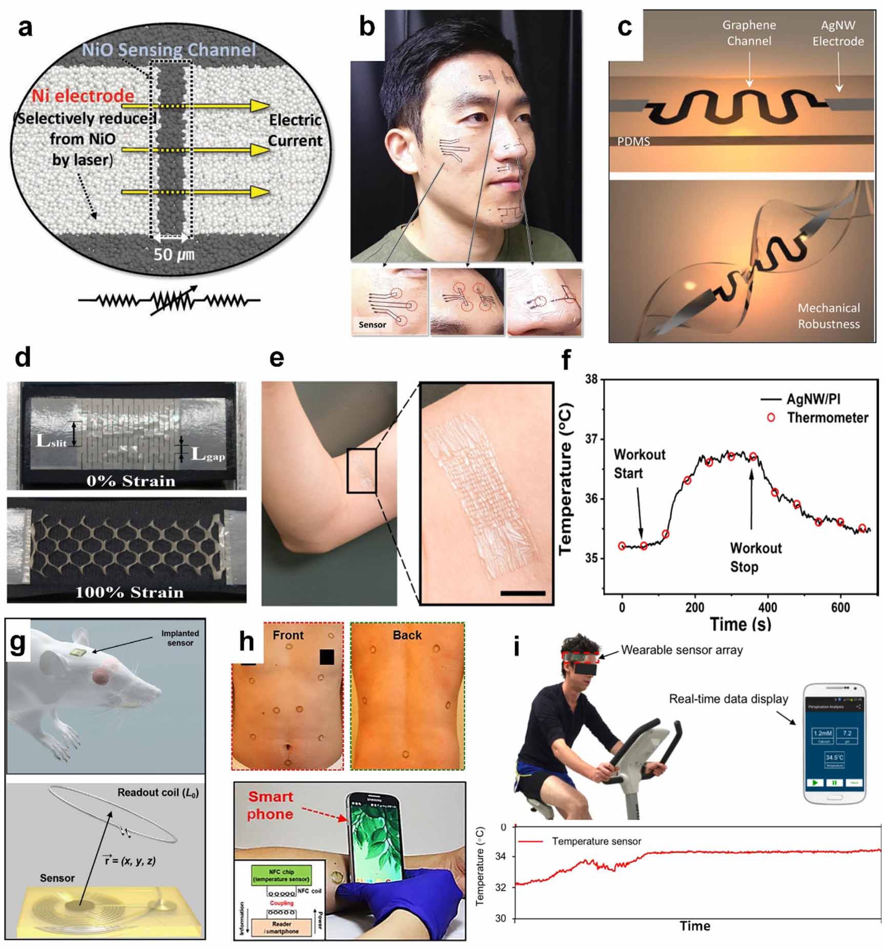 Soft wearable sensors for monitoring symptoms of COVID-19 and other ...