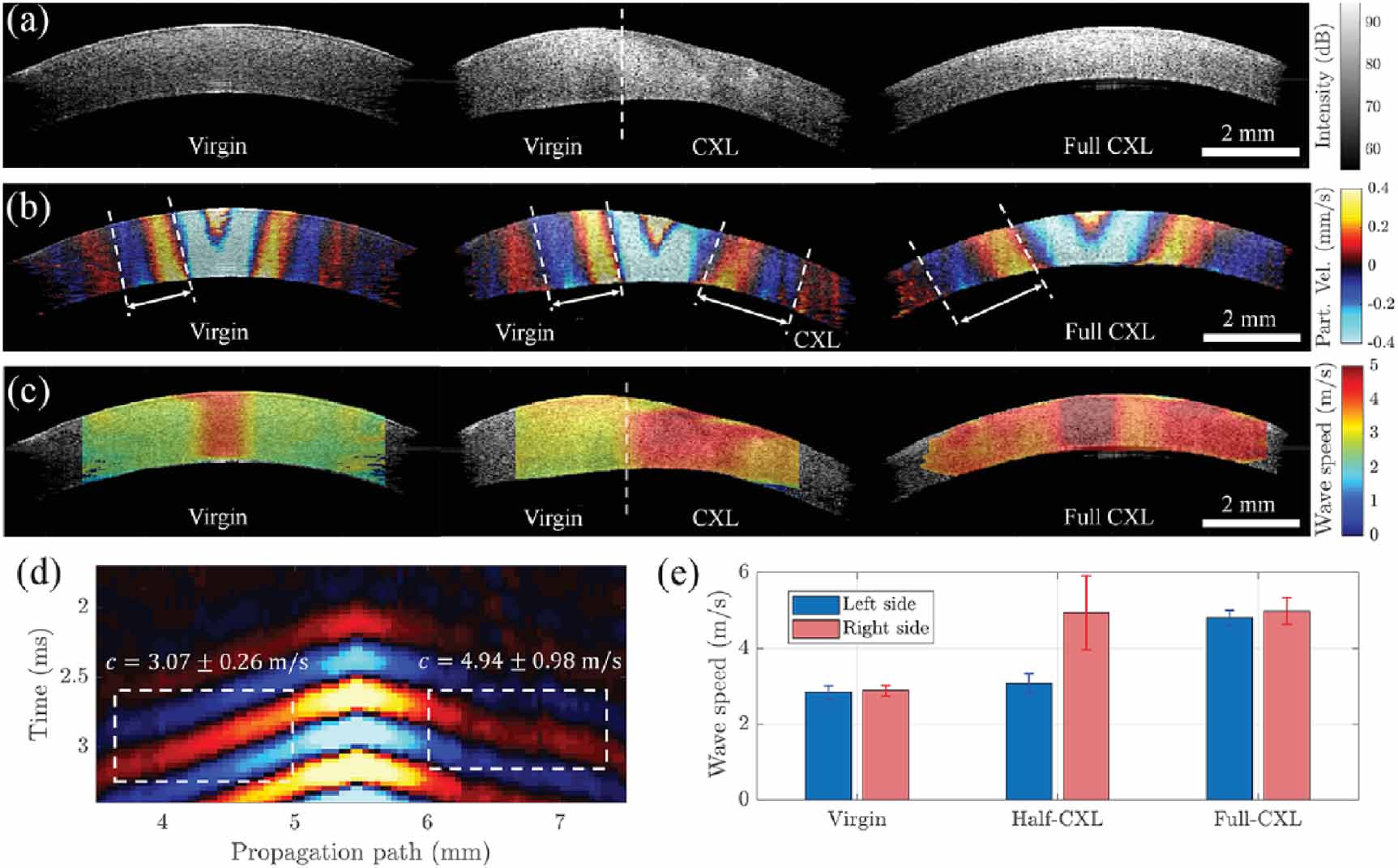 Wave-based optical coherence elastography: the 10-year perspective ...