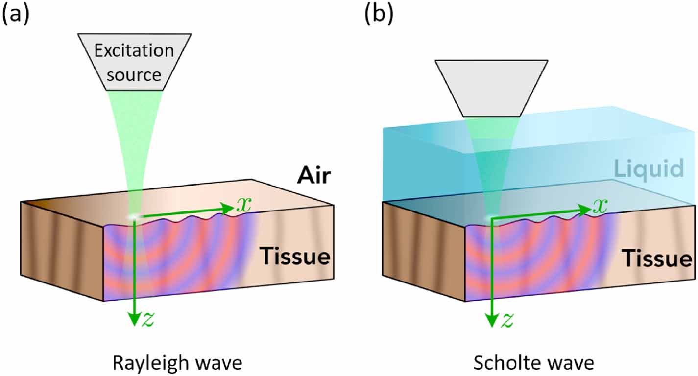 Wave-based optical coherence elastography: the 10-year perspective ...
