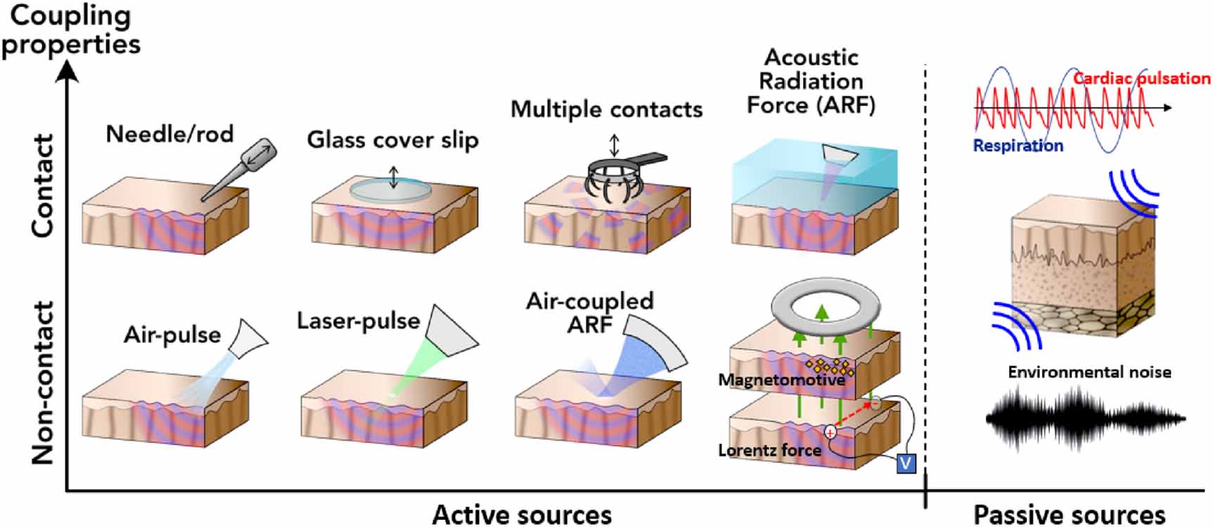 Wave-based optical coherence elastography: the 10-year perspective ...