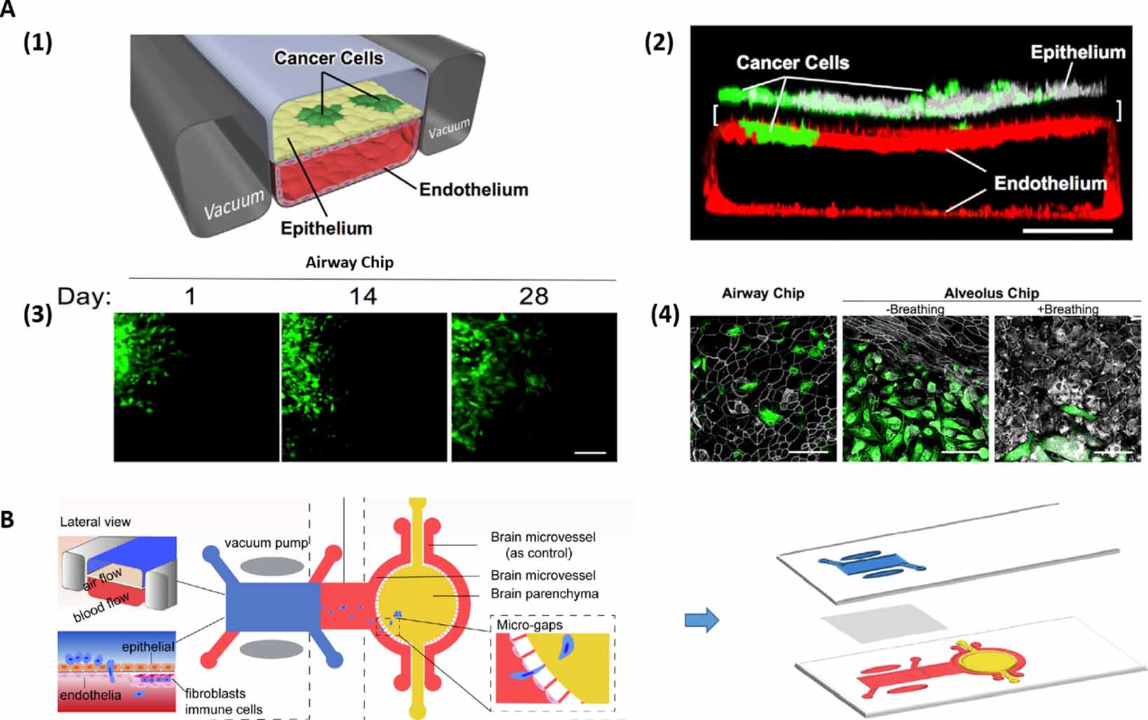 Cancer-on-chip technology: current applications in major cancer types ...