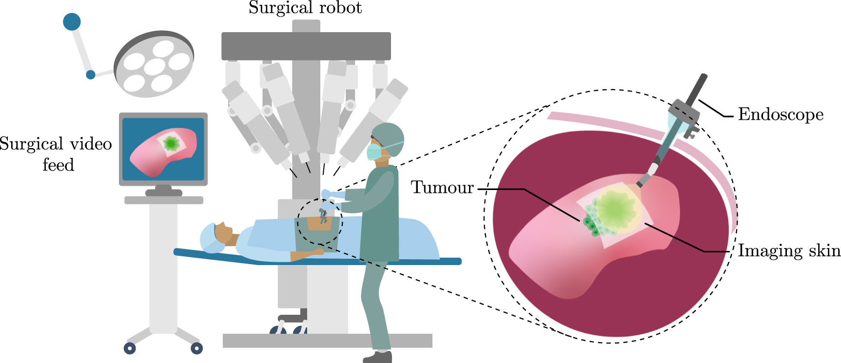 Imaging skins: stretchable and conformable on-organ beta particle ...