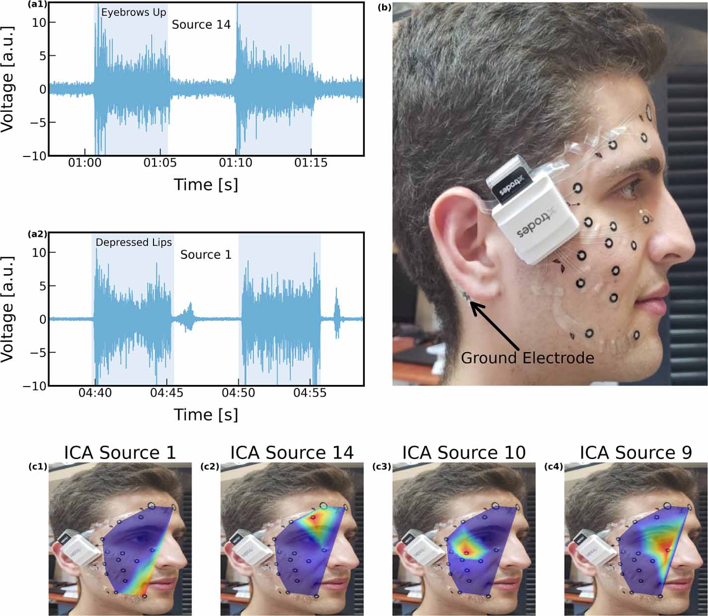 Wearable facial electromyography: in the face of new opportunities ...