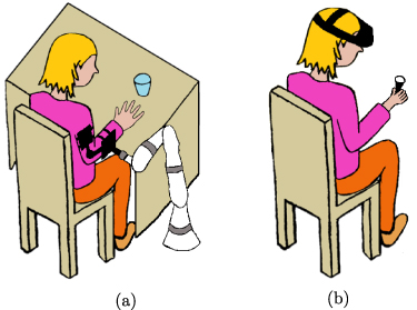 Post-stroke upper limb rehabilitation: clinical practices, compensatory ...