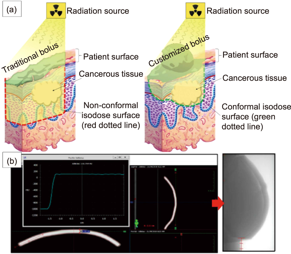 Additive manufacturing in radiation oncology: a review of clinical ...