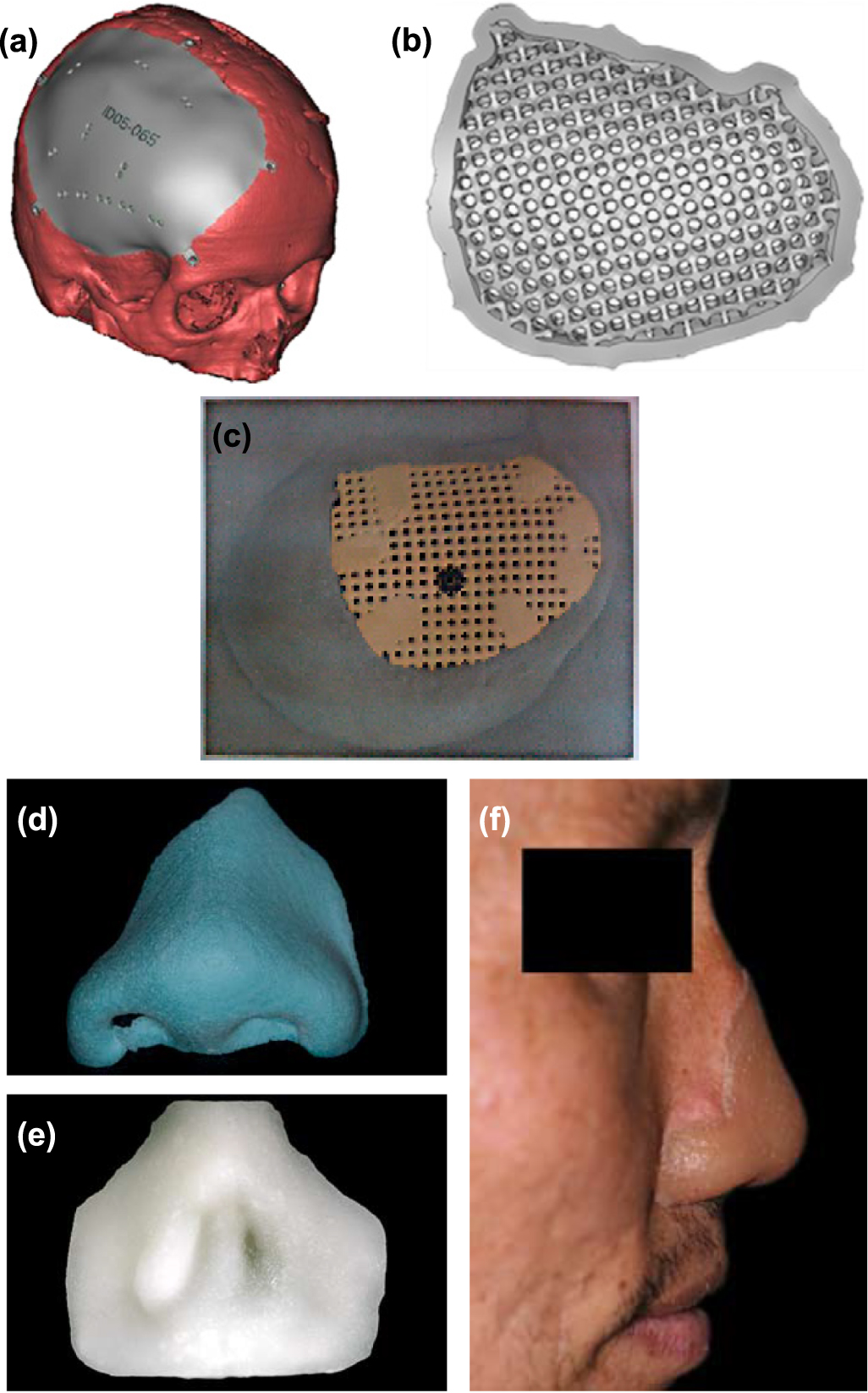 Advances in selective laser sintering of polymers - IOPscience