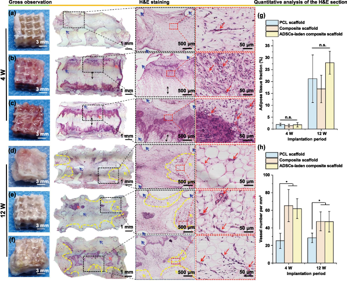 Embedding aligned nanofibrous architectures within 3D-printed polycaprolactone scaffolds for ...