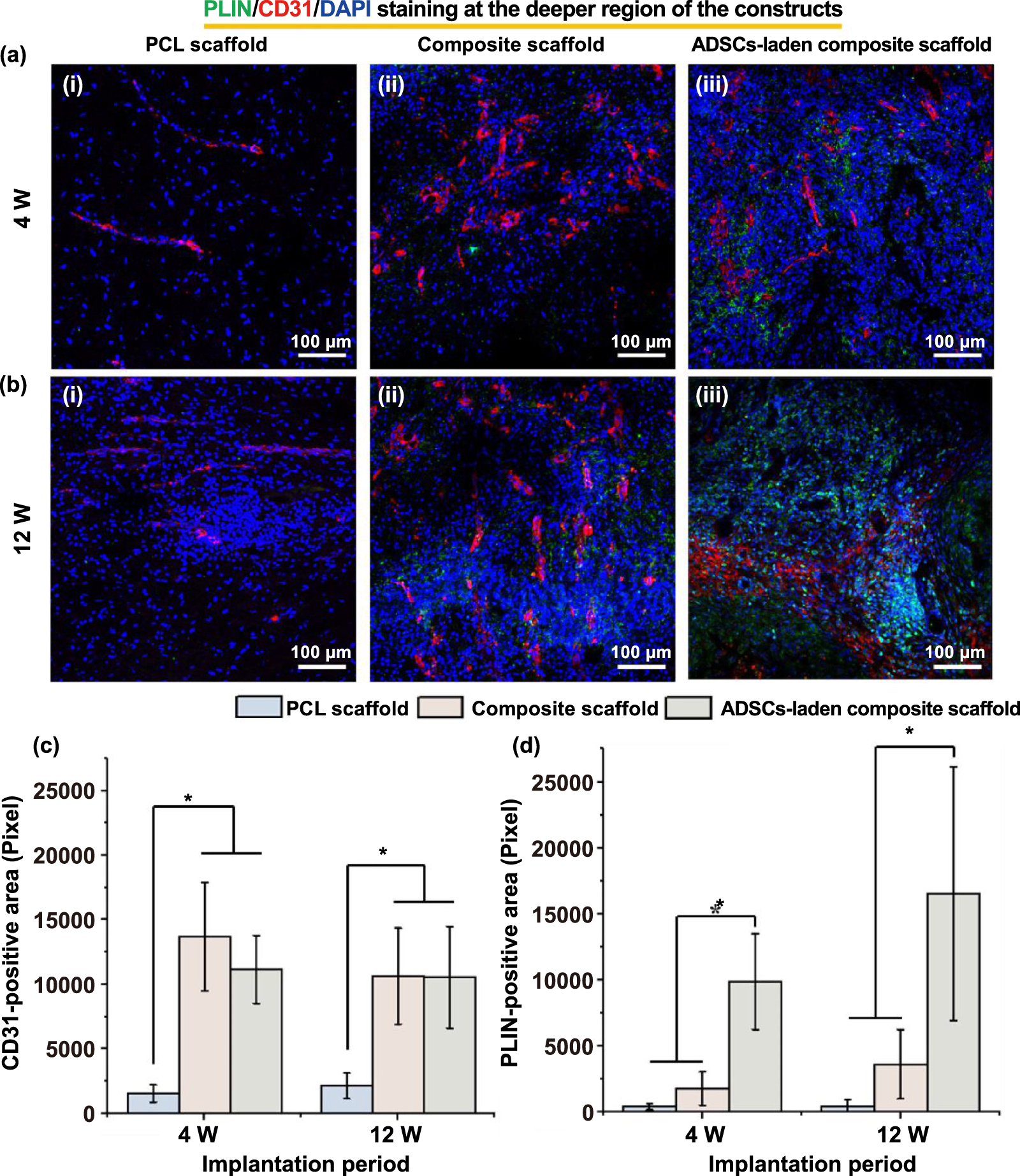 Embedding aligned nanofibrous architectures within 3D-printed polycaprolactone scaffolds for ...