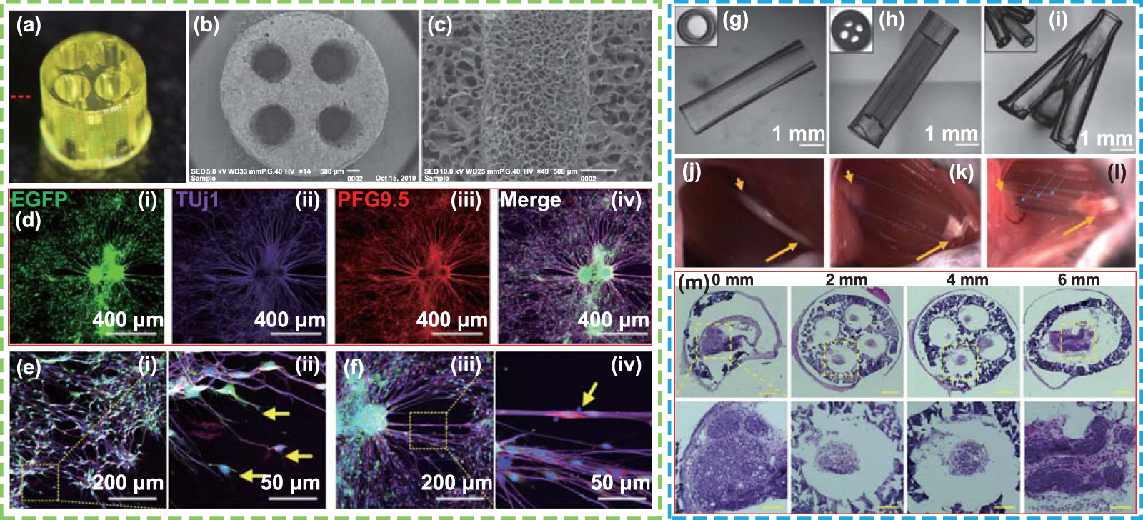 Advances in 3D printing scaffolds for peripheral nerve and spinal cord ...