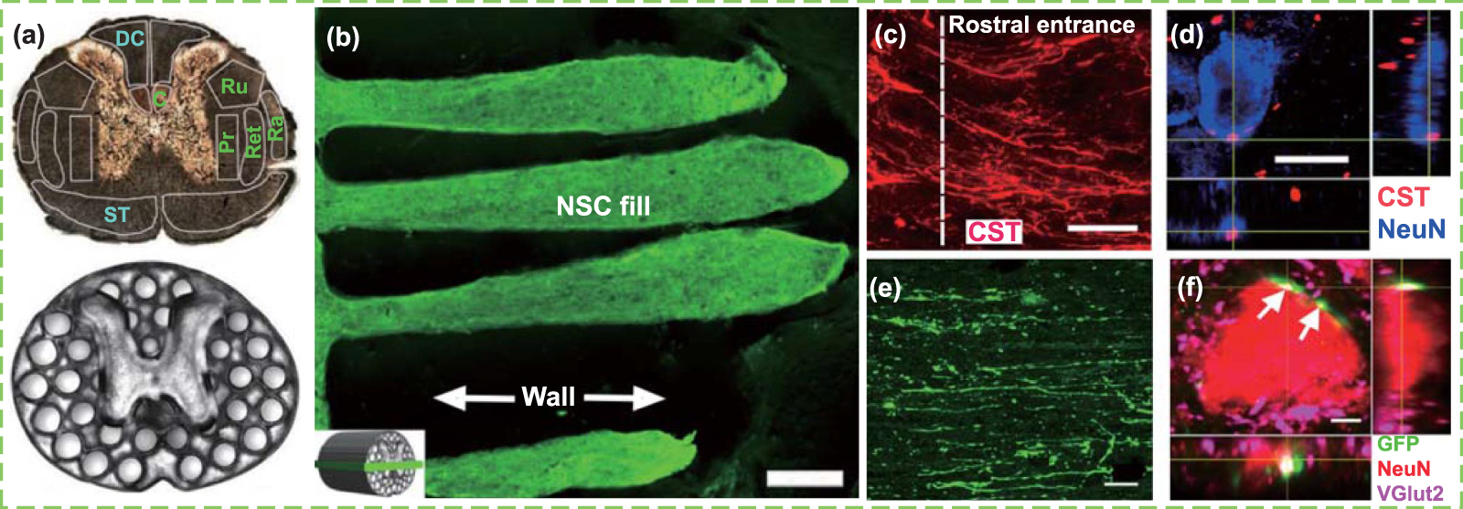 Advances in 3D printing scaffolds for peripheral nerve and spinal cord ...