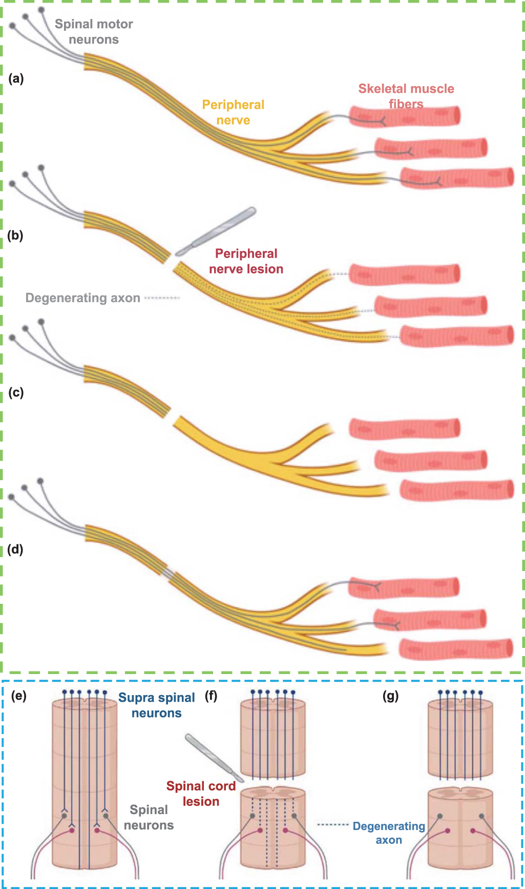 Advances in 3D printing scaffolds for peripheral nerve and spinal cord ...