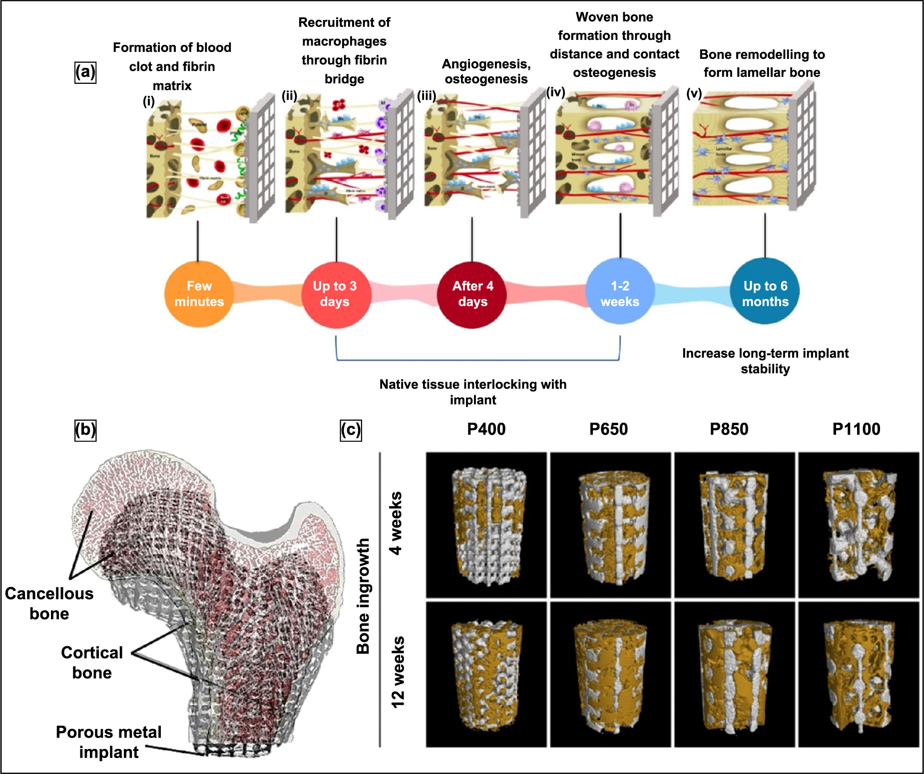 Porous metal implants: processing, properties, and challenges - IOPscience