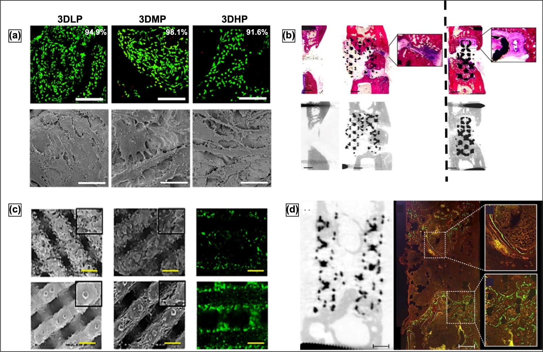Porous metal implants: processing, properties, and challenges - IOPscience