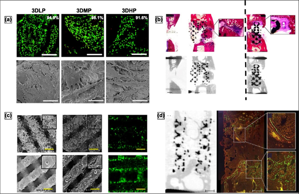 Porous metal implants: processing, properties, and challenges - IOPscience