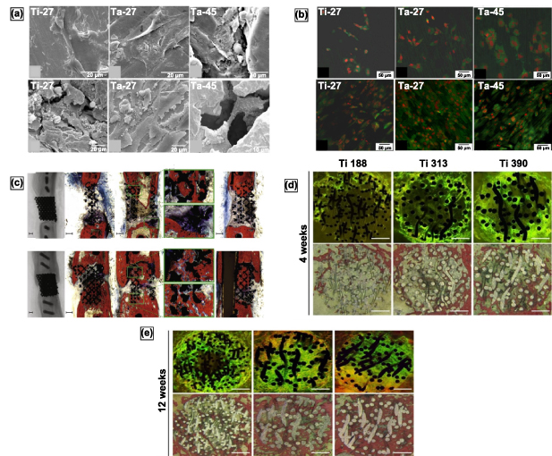 Porous metal implants: processing, properties, and challenges - IOPscience