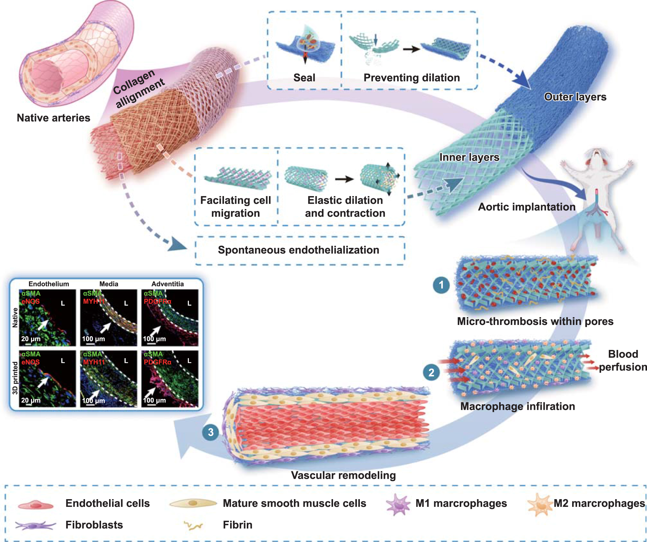3D printed grafts with gradient structures for organized vascular ...