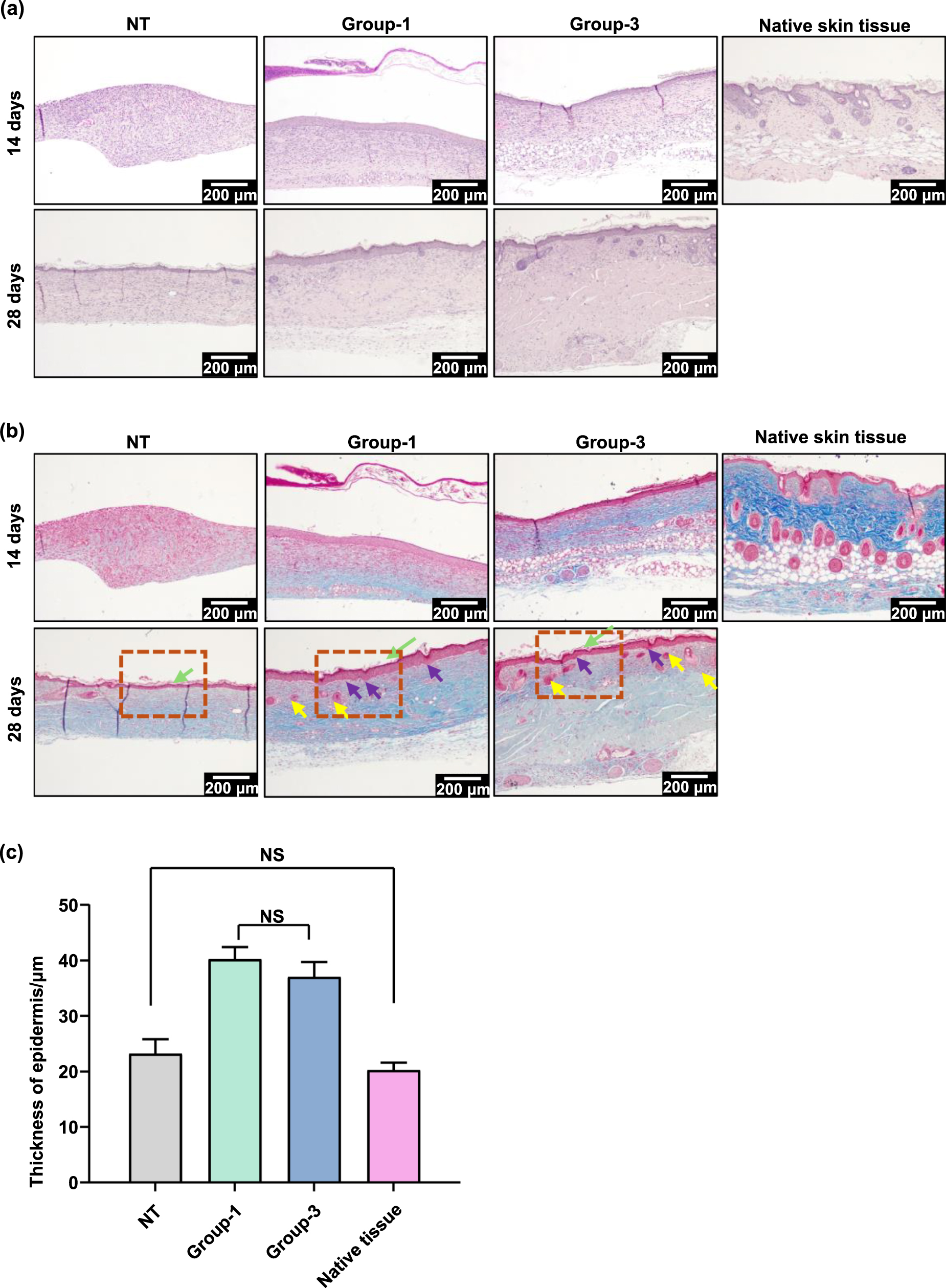 Bioengineered skin-substitutes incorporating rete-ridges using a ...