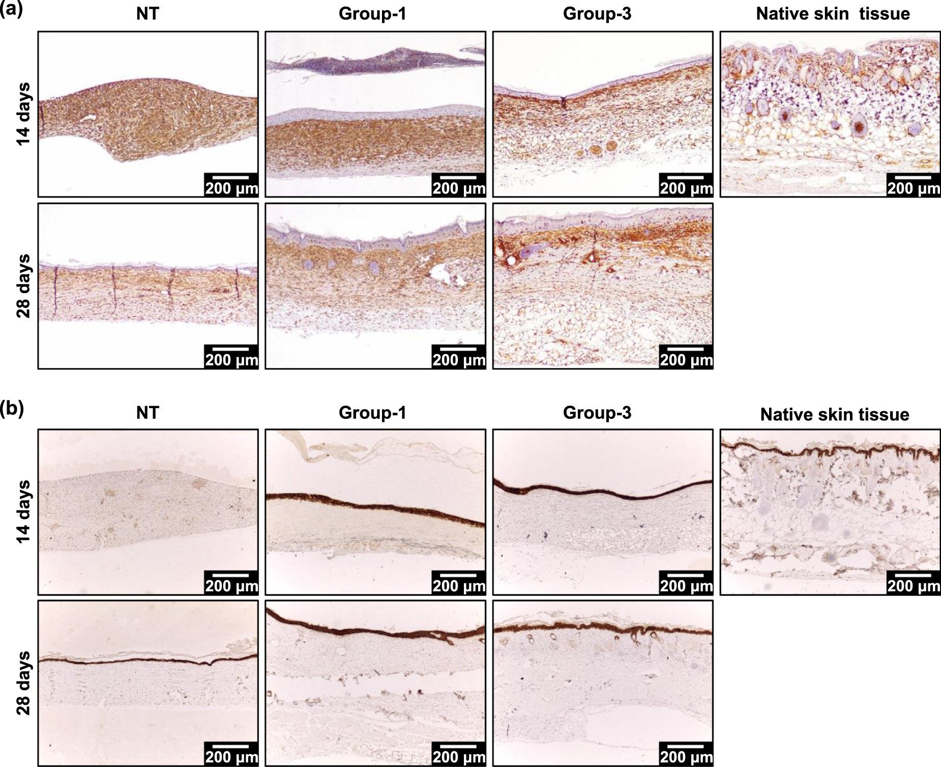 Bioengineered skin-substitutes incorporating rete-ridges using a ...