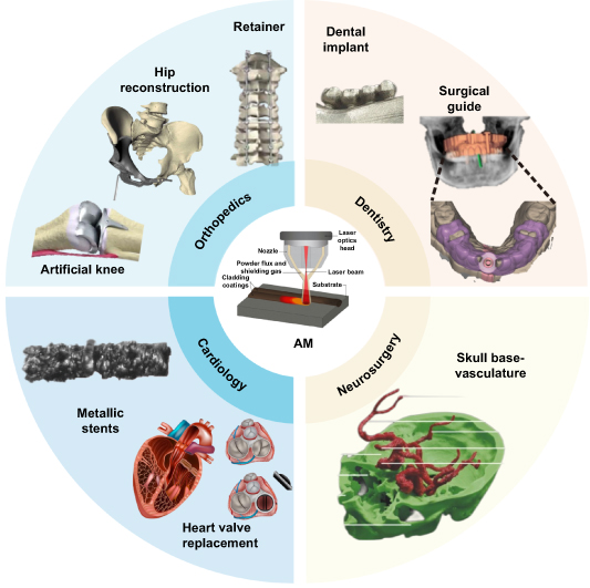 Revolutionizing medical implant fabrication: advances in additive ...