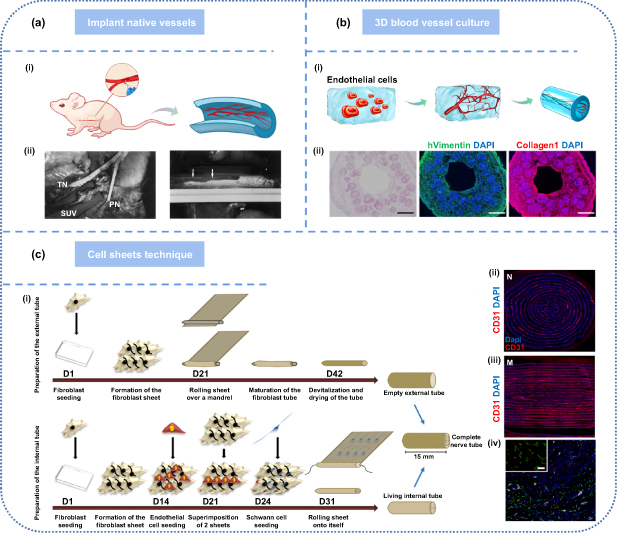 Neurovascularization strategy: pathfinder and interlocutor for ...