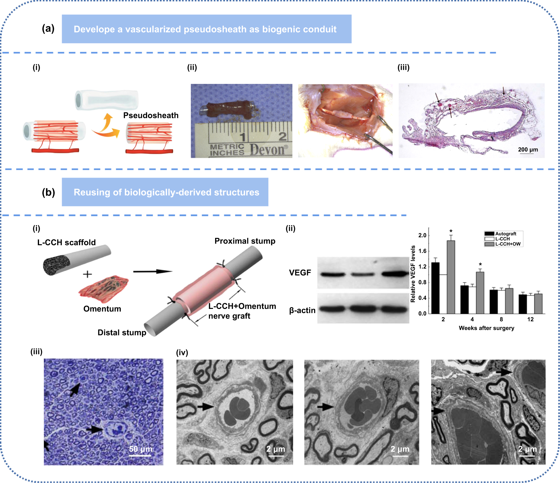 Neurovascularization strategy: pathfinder and interlocutor for ...