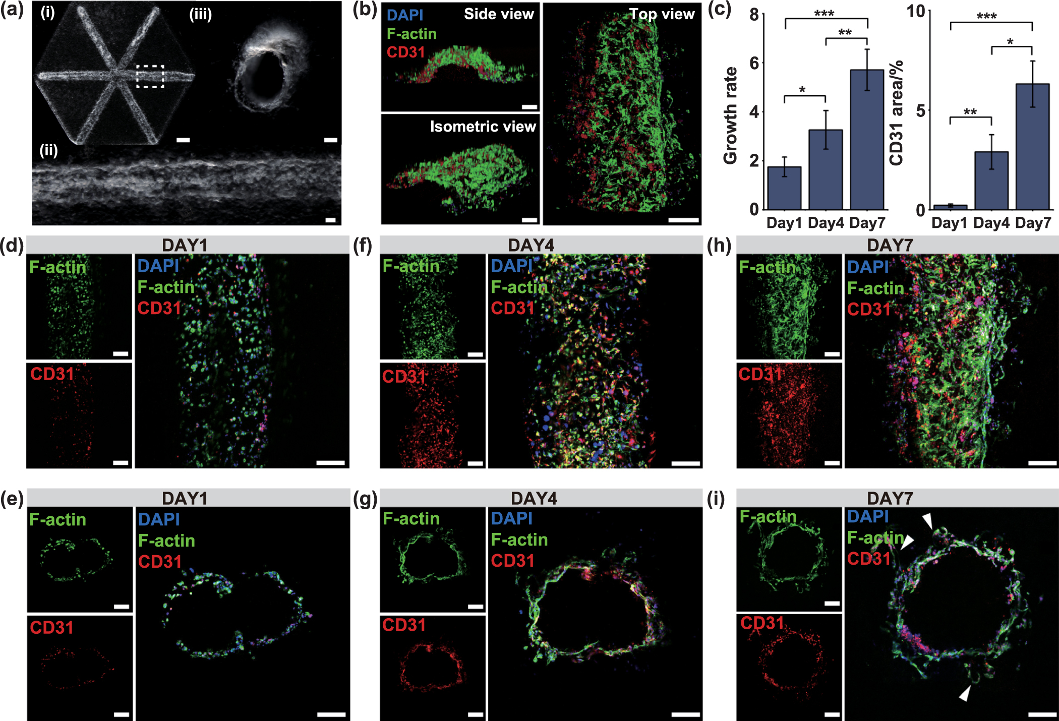 Construction of complex three-dimensional vascularized liver tissue ...