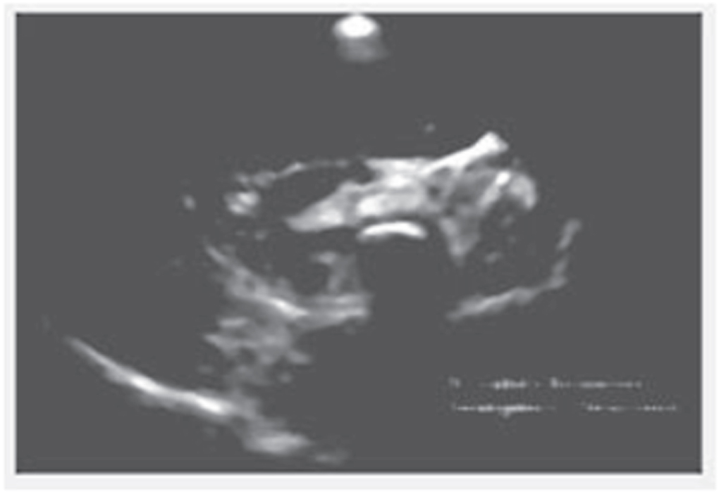 Detection of kidney stone using digital image processing: a holistic ...