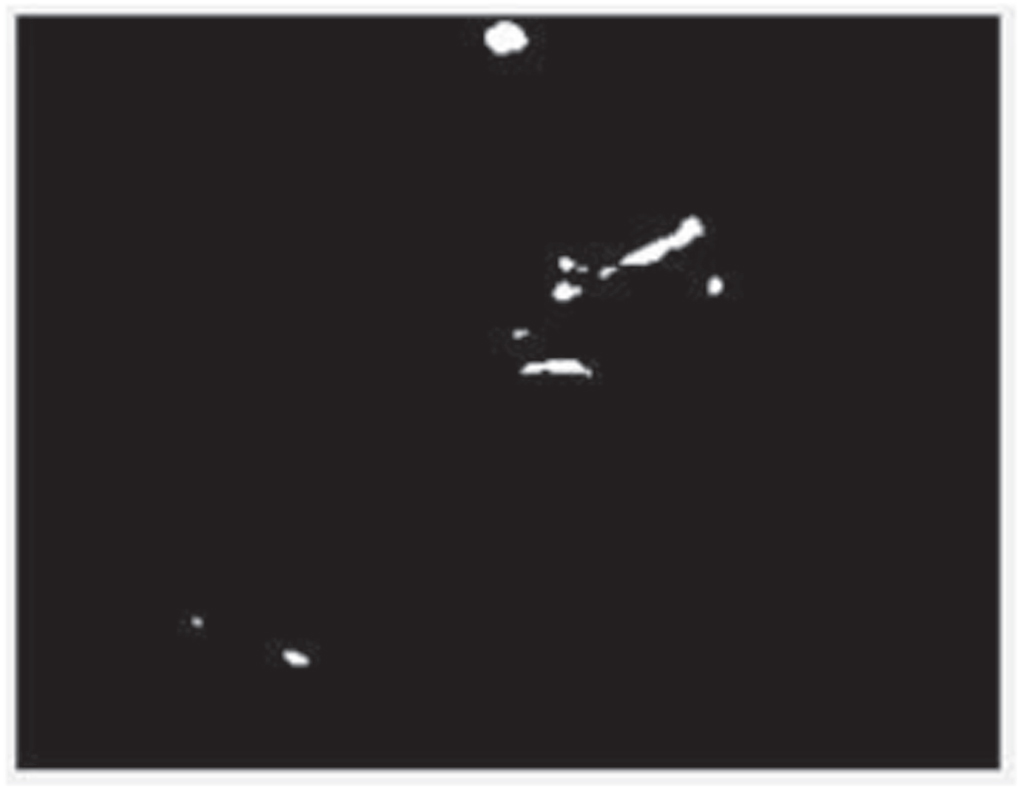 Detection of kidney stone using digital image processing: a holistic ...