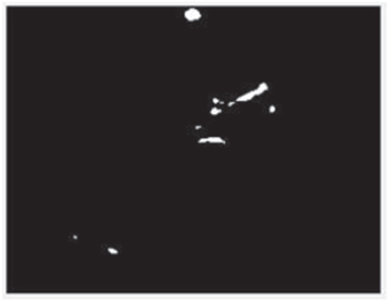 Detection of kidney stone using digital image processing: a holistic ...