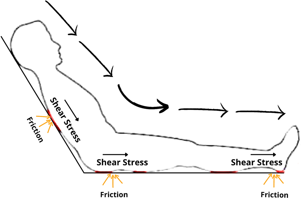 Sensors for the measurement of shear stress and shear strain-a review ...