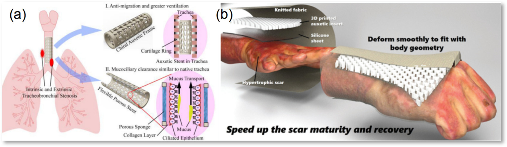 Auxetic meta-materials and their engineering applications: a review ...