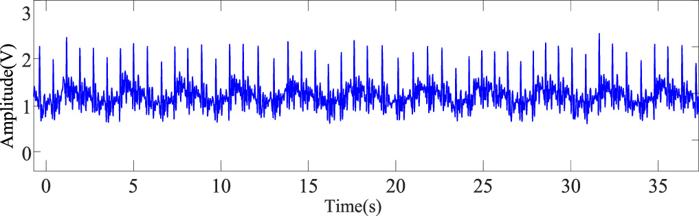 Heart rate detection of ballistocardiogram based on improved DAE and template matching method ...