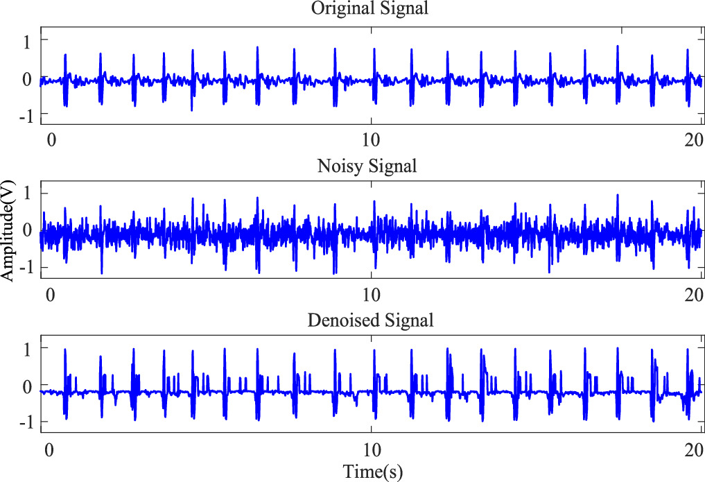Heart rate detection of ballistocardiogram based on improved DAE and template matching method ...
